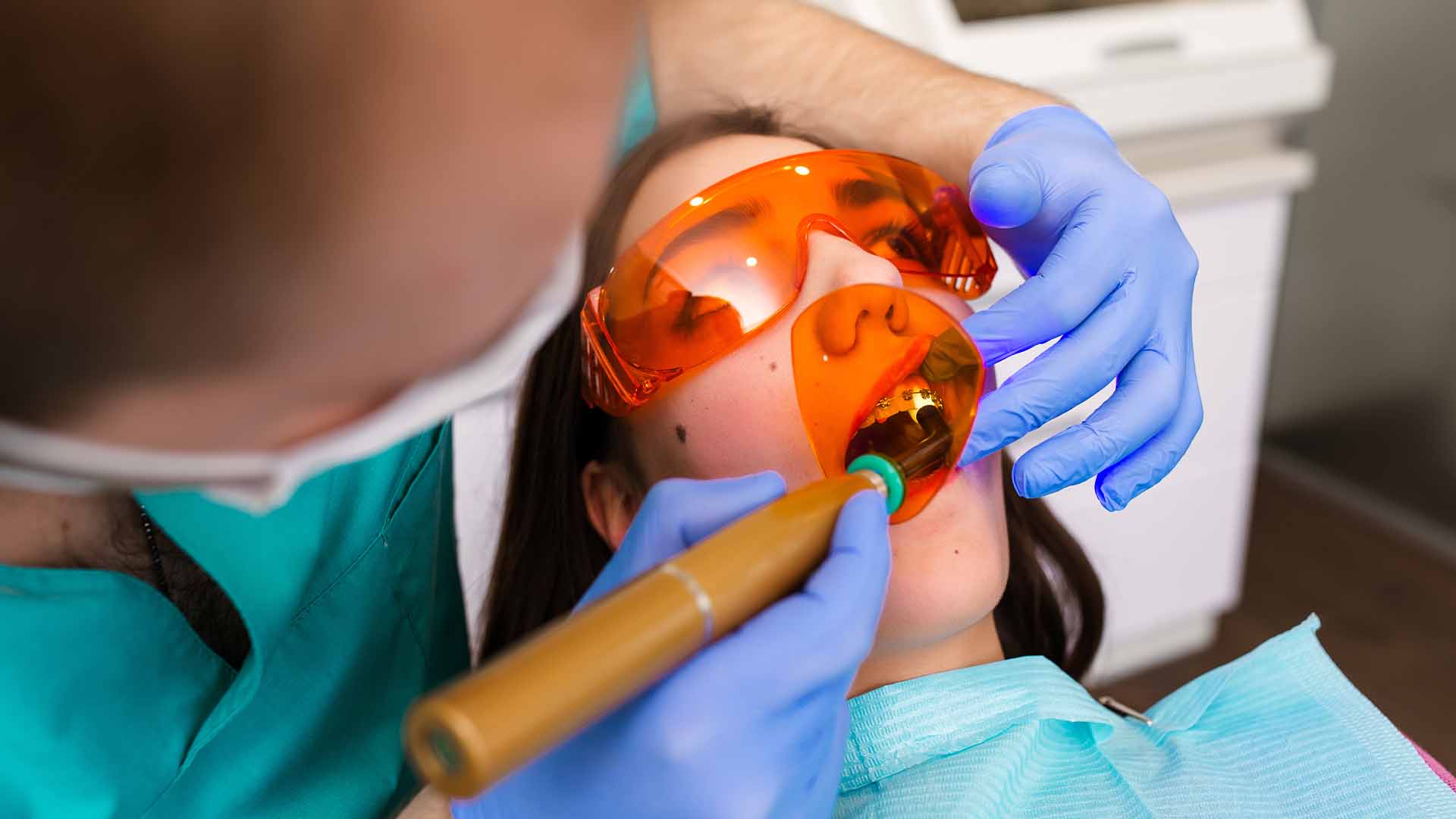 Restauração Onlay: Como é feita e quando indicar?